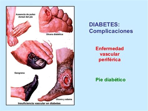 Índice De Mortalidad A Causa De La Diabetes