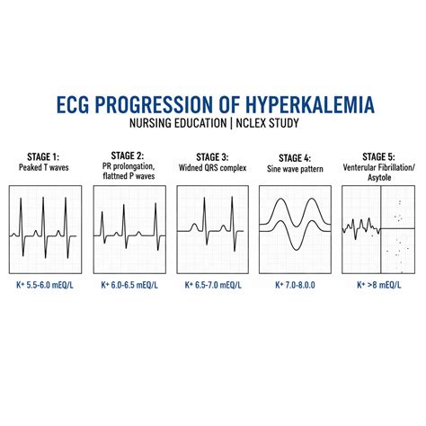 Hyperkalemia Ecg From Peaked T Waves To Cardiac Arrest