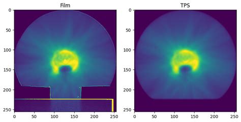 Dicom Example — Dosepy Jupyter Book