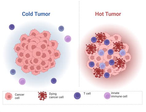 Turning Cold Tumors Hot In Melanoma
