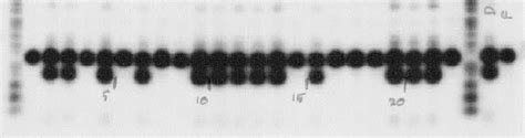 Sex Specific Marker Segregation Within Members Of A Mapping Family Download Scientific Diagram
