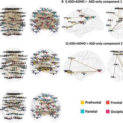 Whole Brain Network Differences Between Groups P Download Scientific Diagram
