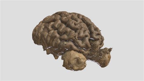 Human Brain Visual Pathway Download Free 3d Model By Cu Modern Human Anatomy Program [f82dd24