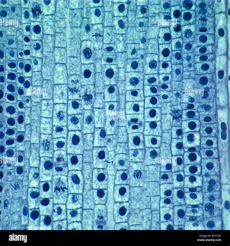 Mitosis Cell Division In Onion Root Tip Stained Microslide Section Brightfield Photomicrograph