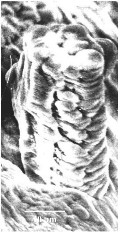 Particular Of The Sub Structure Of The Arrangement Of The Yeast