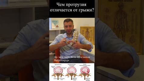 Протрузия дисков позвоночника что это такое симптомы лечение