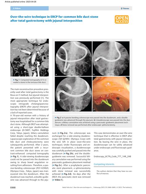 Pdf Over The Wire Technique In Ercp For Common Bile Duct Stone After Total Gastrectomy With