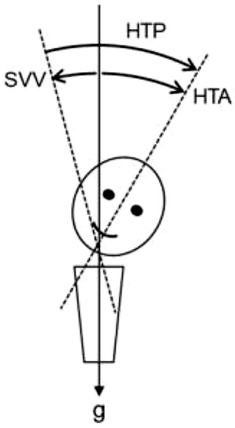 Head Roll Tilt Subjective Visual Vertical Test In The Diagno Otology And Neurotology