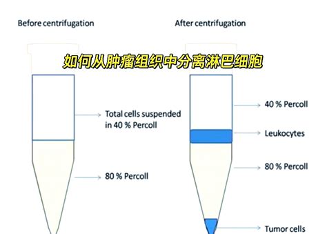 如何从肿瘤组织中分离淋巴细胞：实验指南