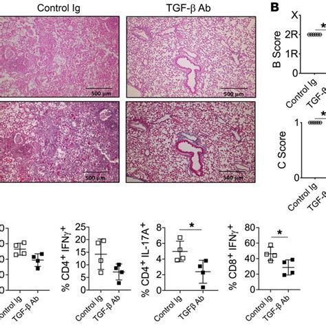 Tgf β Blockade Prevents Intragraft Ifn γ Cd8 T Cell Accumulation Download Scientific