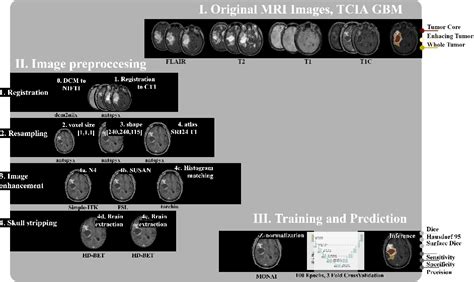 Neglectable Effect Of Brain Mri Data Prepreprocessing For Tumor Segmentation