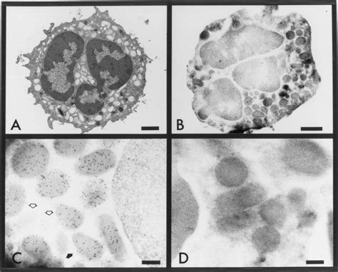 Transmission Electron Microscopy A Bovine Neutrophil Stained For Download Scientific Diagram