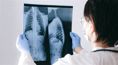 Tuberculosis Patient