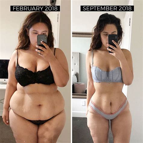 Woman Reveals Before And After Pictures Of Her 141 Pound Weight Loss