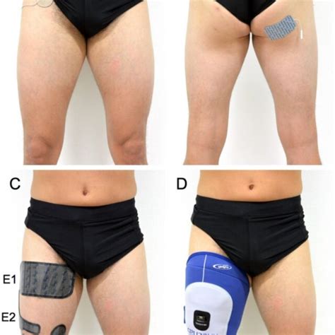 Representation Of The Two Electrode Configurations Used For Electrical Download Scientific