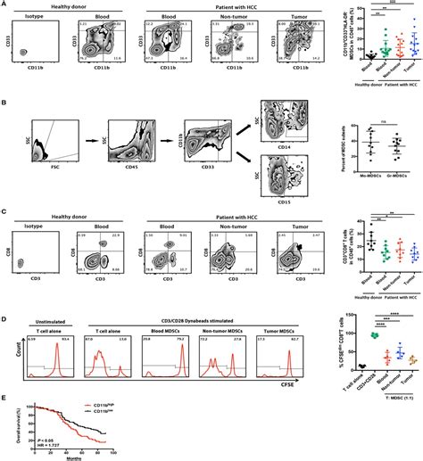 Receptor‐interacting Protein Kinase 3 Deficiency Recruits My Hepatology
