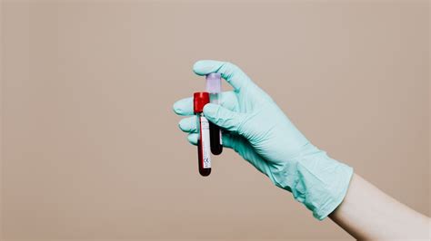 How Often Should I Get Tested For Stds Learn More Better Life Science