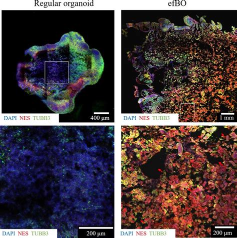 Comparison Of Tissue Core Between Regular Brain Organoids And Efbos