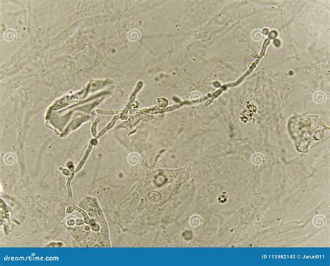 Pseudohyphae And Budding Yeast Cells In Urine Stock Image Image Of Gonorrhoeae Biology 113582143