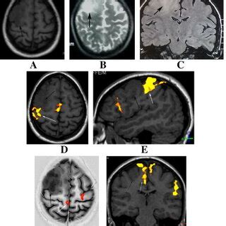 Different Relations Between The Eloquent Brain Areas And The Brain Download Scientific Diagram