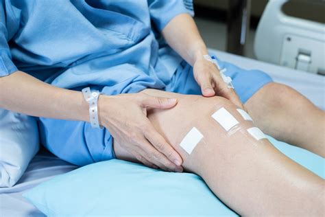 What Is PCL Reconstruction