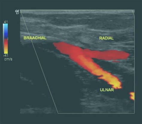 Ch 13 Lip Video Flashcards Quizlet