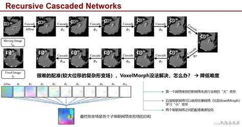 医学图像配准概览和深度学习图像配准前沿热点论文voxelmorph 时间序列图像配准 csdn博客