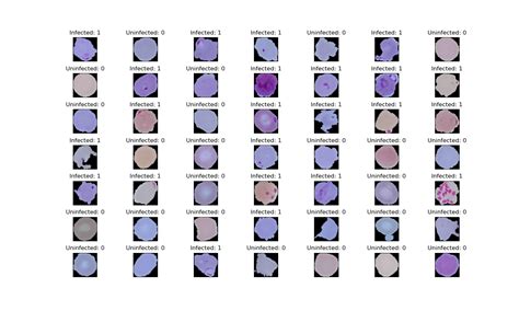 Github Metehannguzelmalaria Cell Detection Cnn