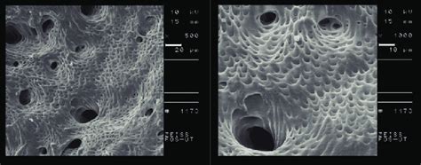 Scanning Electron Microscopic Evaluation Of Dentin Samples To Confirm Download Scientific