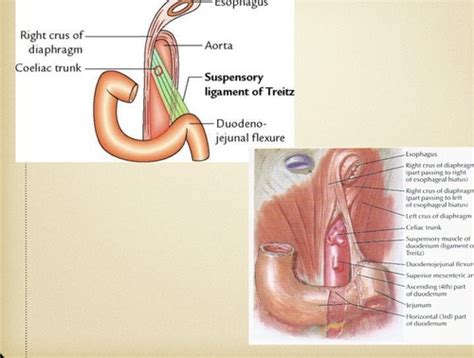 Upper GIT Bleeding Flashcards Quizlet