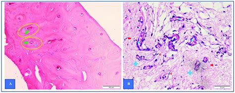 Color Histological Evaluation Of Specimens Histological Examinations