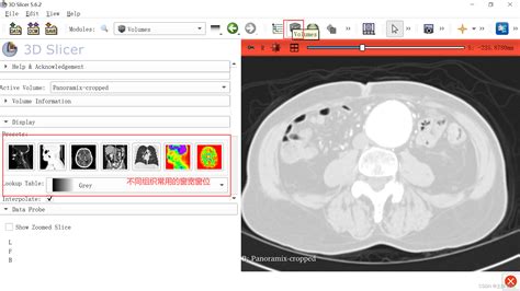 3d slicer的学习（一）（win10环境） 设置3d slicer python环境设置 csdn博客