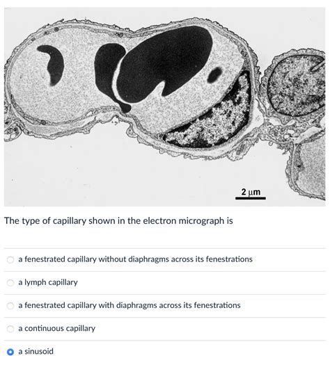 Solved The Type Of Capillary Shown In The Electron