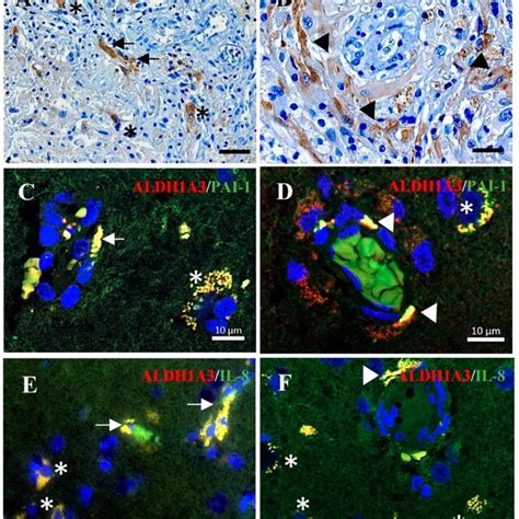 Immunohistochemistry And Immunofluorescence Staining On Gbm Sections Download Scientific