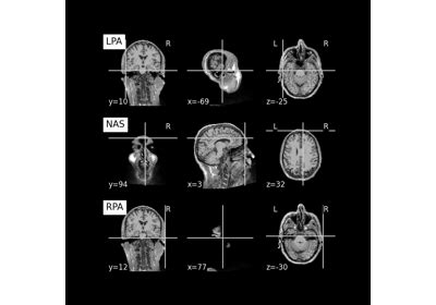 Mne Bids Write Raw Bids MNE BIDS Documentation