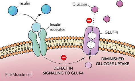 Pathophysiology Of Type 2 Diabetes Mellitus Download Scientific Diagram