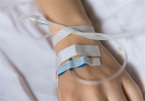 Driving After Wisdom Teeth Removal With Iv Sedation A Quick Guide