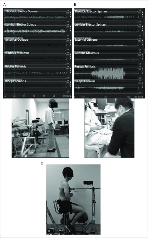 Surface Electromyogram Waveform And Simultaneous Photograph A Download Scientific Diagram