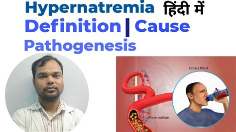 Hypernatremia Definition Cause Pathogenesis Explained Clearly In Hindi Youtube