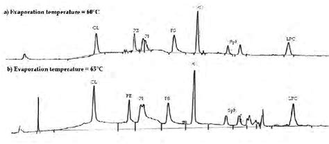 Np Hplc Elsd Trace Of A Standard Pl Mixture Cl Pe Pi Ps Pc Sph Lpc Download Scientific