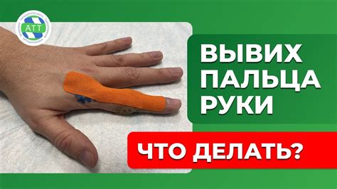 Тейпирование пальца Боль в пальце Вывих пальца Youtube