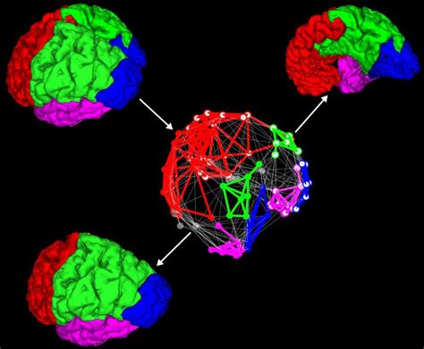 le 3d coalescent embedding of structural brain networks highlights the