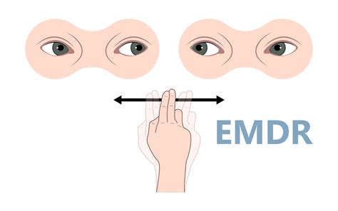 ДПДГ Emdr что это техника как работает терапия РБК Life