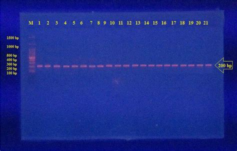 Genotyping Of Gene Variants Of Vdr Rs 1544410 Genotype Variants Of Download Scientific