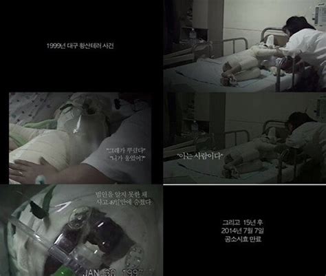 ‘대구 어린이 황산 테러 사건이 공소시효 만료결국 영구 미제로 스포츠동아