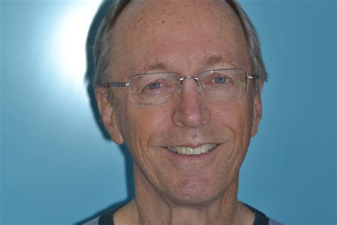 Cosmeticsmile Cases In Berkeley Ca Dr Brian Assael Dds