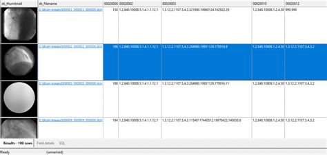 Dicom Search Querying The Database Preview 2 Yohz Software Development Blog