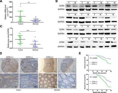 Expression Of Ccr4 And Its Clinical Significance In Crc Patients A Download Scientific