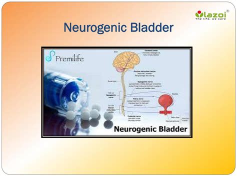 Ppt Neurogenic Bladder Causes Symptoms Daignosis Prevention And Treatment Powerpoint