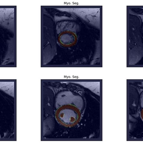 Example Of Myocardial Segmentation For The Proposed Convolutional Download Scientific Diagram